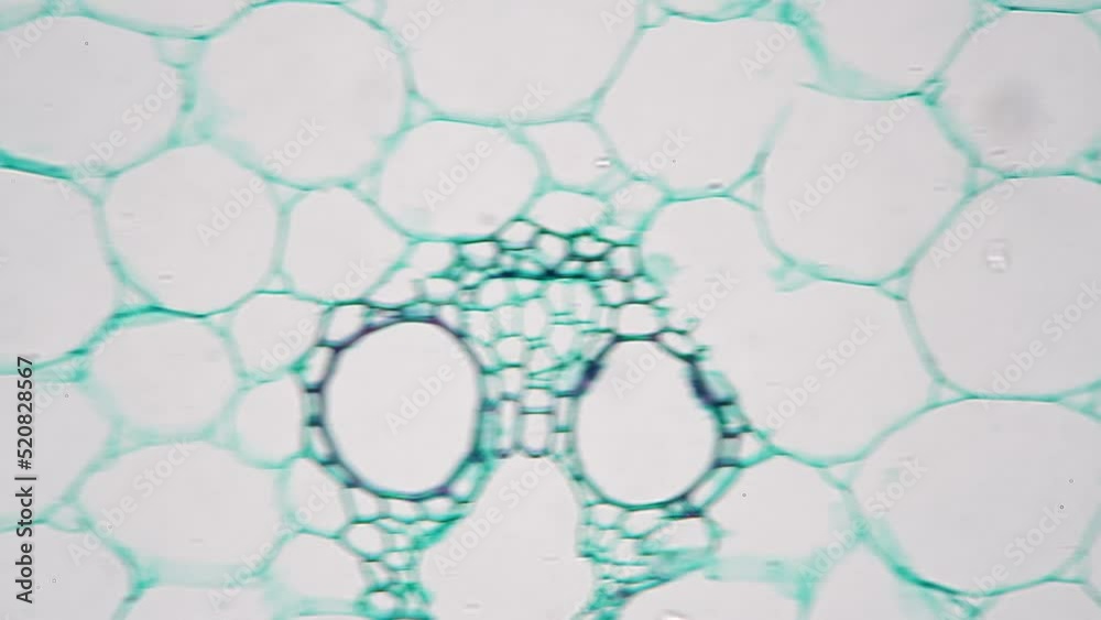 Monocotyledon Stem in transversal section cut under the microscope 400x ... Monocotyledon Stem in transversal section cut under the microscope 400x ...