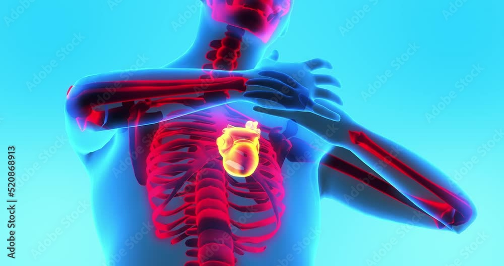 Signs Of Heart Attack. Adult Male Having Pain. X-Ray Image. Medical And ...