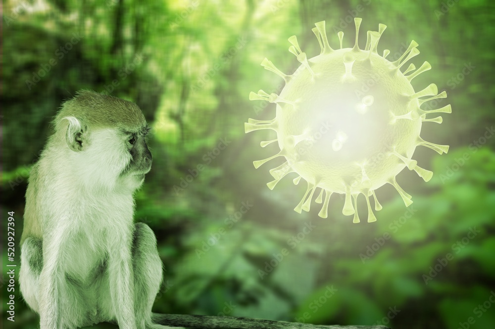 Monkeypox outbreak concept. Monkeypox is a viral zoonotic disease. MPXV ...