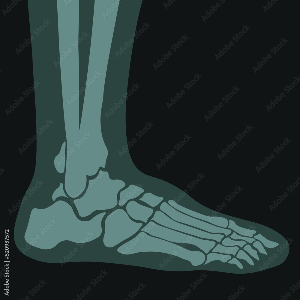 Xray of foot, joints and bones roentgen scans Stock Vector | Adobe Stock