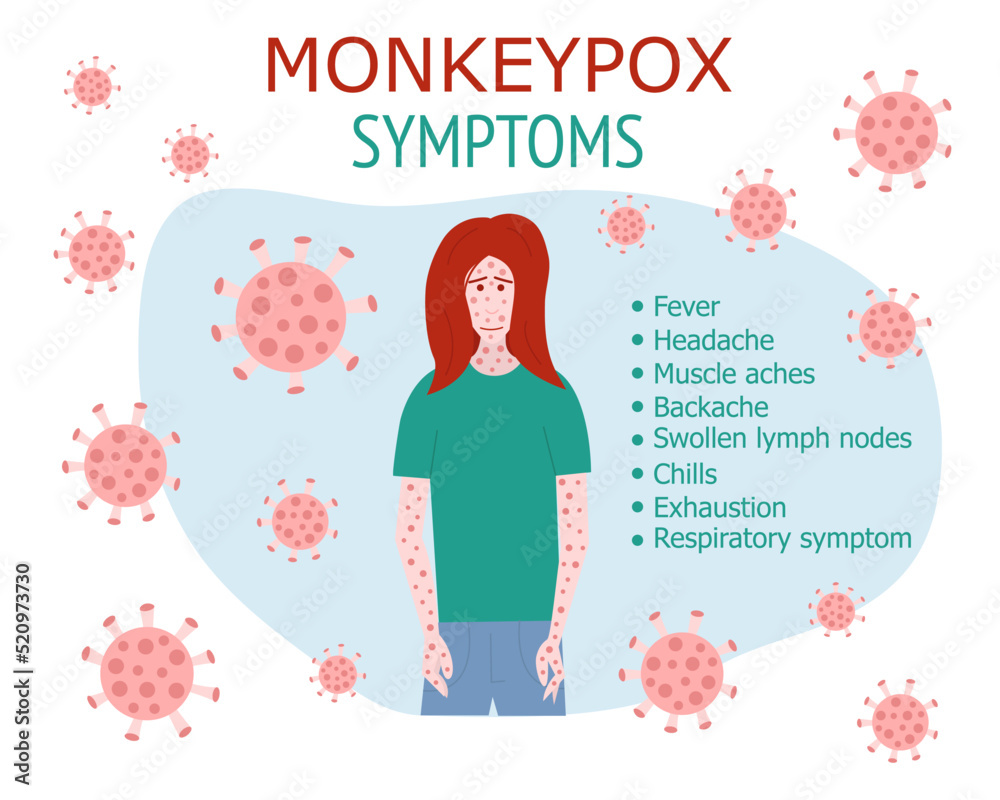 Monkey pox infographic symptoms on human vector illustration. Monkey ...