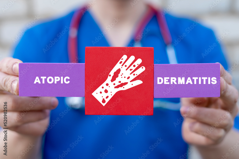 Concept of atopic dermatitis. Diagnosis and treatment. Dermatology ...