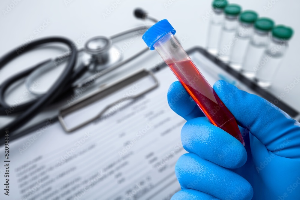 Blood sample tube for analysis Test. Blood tube test with requisition ...