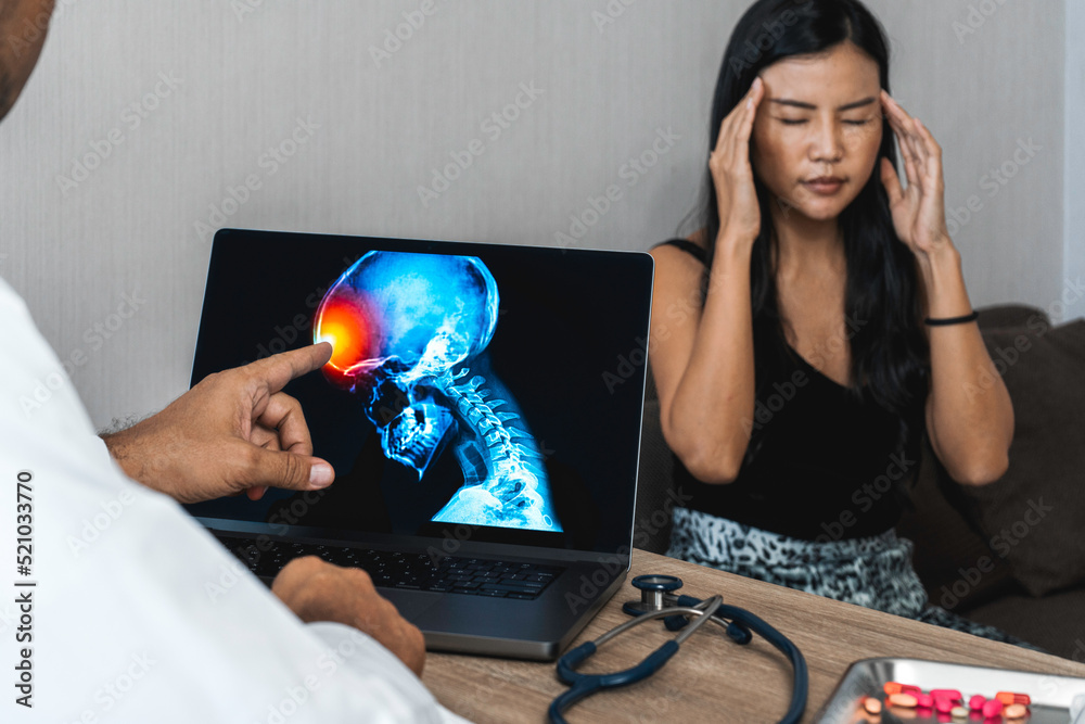 Doctor showing a x-ray of pain in the brain on a laptop. Migraine ...