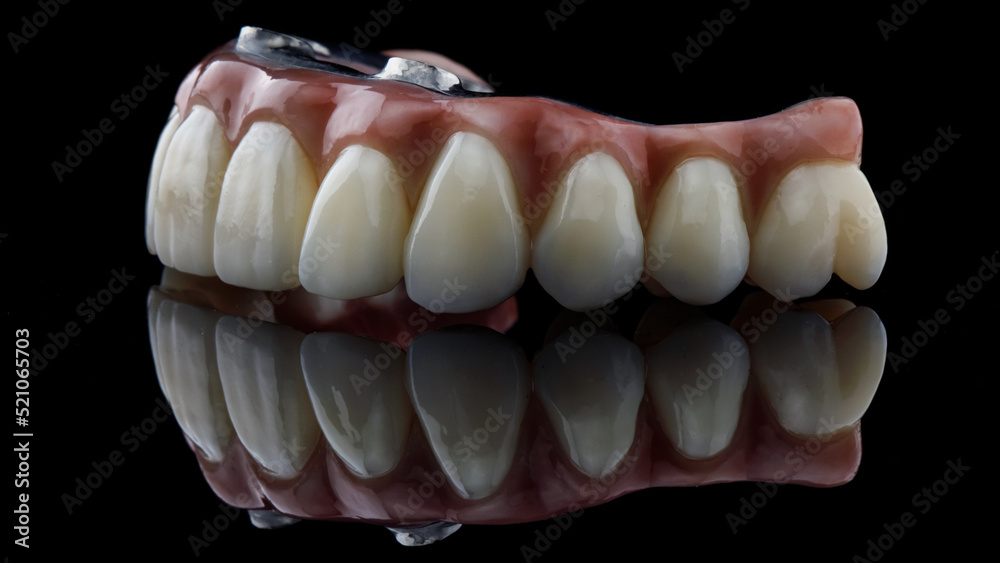 zircon dental prosthesis with artificial gum and titanium bar on black ...