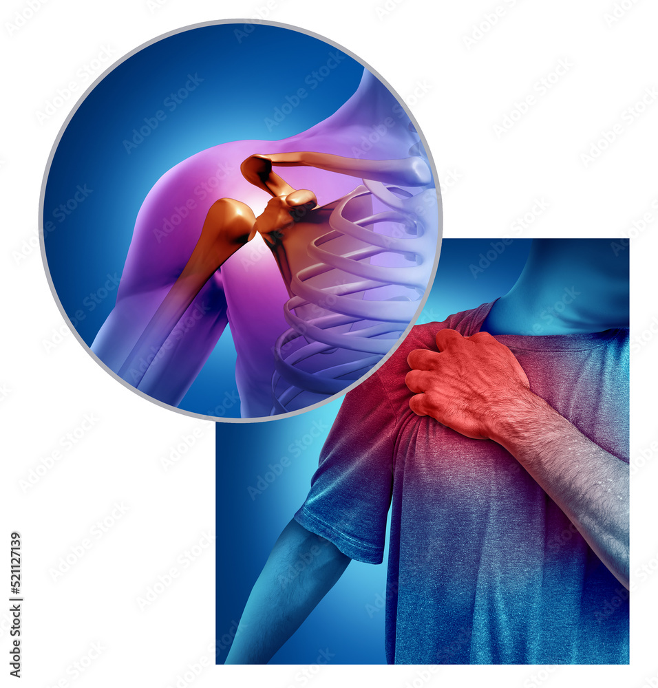 Shoulder pain and injury to shoulders caused by sports accident or ...