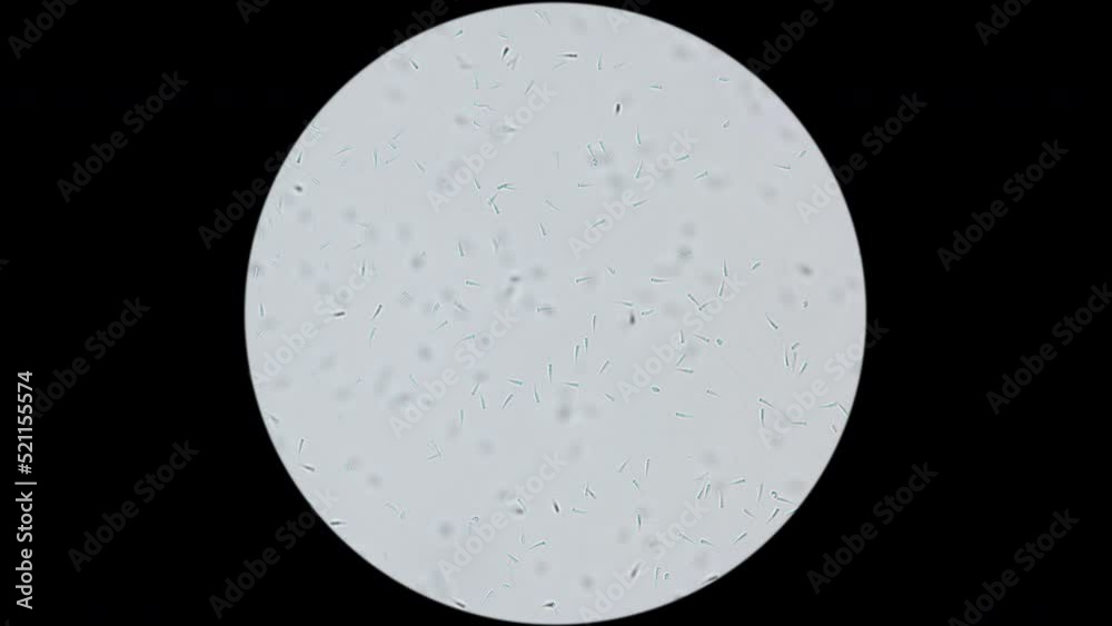 Cerebratulus worm sperm under microscope, Nemertea Phylum, Family ...