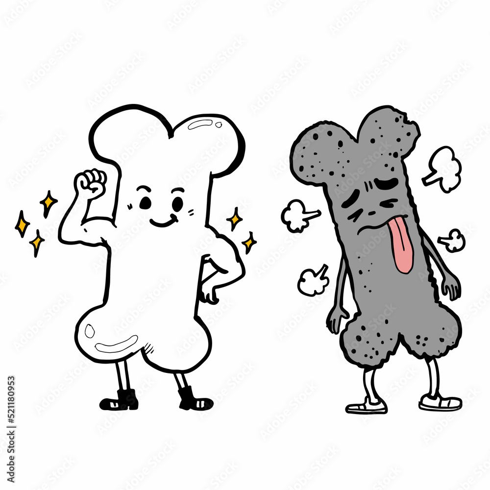 cartoon healthy dense bone and poor bone mass osteoporosis Stock ...