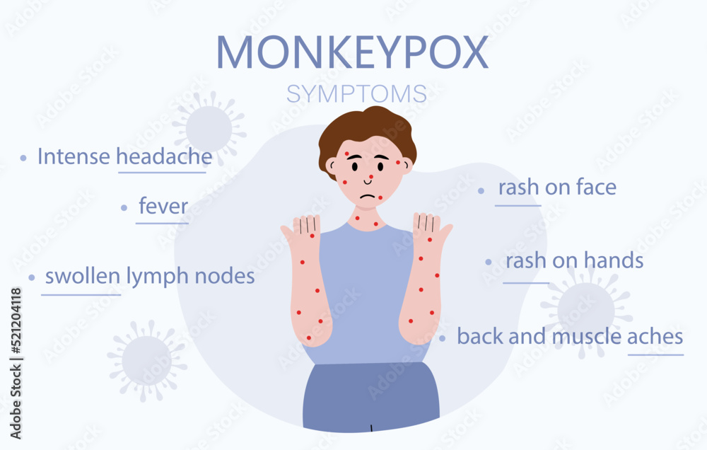Monkeypox virus outbreak symptoms illustration flor world health ...