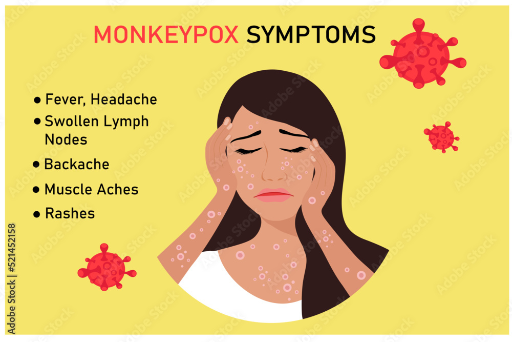 Monkeypox virus symptom concept. Patient with symptom of monkey pox ...