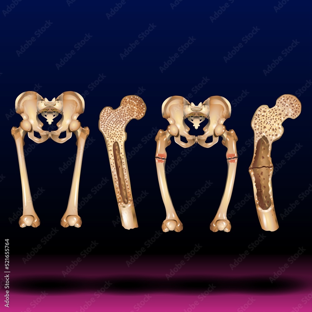 Structure of the pelvis. Anatomical poster of human skeleton. Pelvic ...
