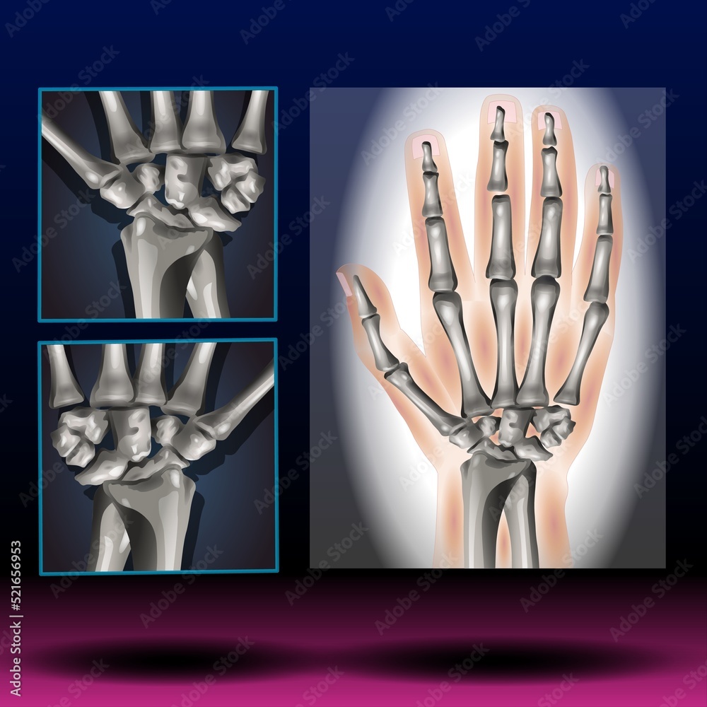 Wrist Anatomy - Fla source file available - Carpal bones. Human hand ...