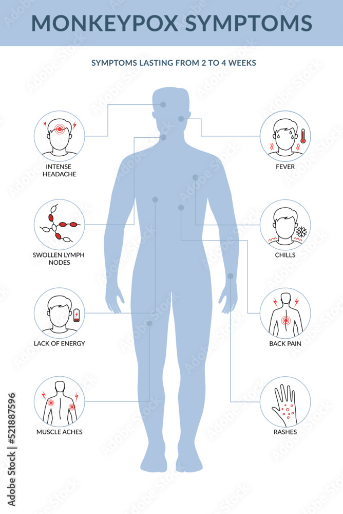 Monkey pox symptoms infographic. It cause skin infections. Flat line ...