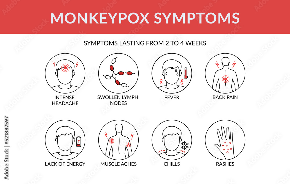 Symptoms of the monkey pox virus infographic. This causes skin ...