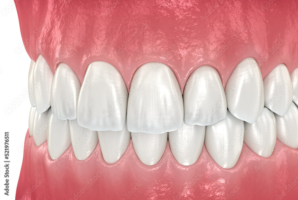 Healthy human teeth with normal occlusion, side view. Medically ...