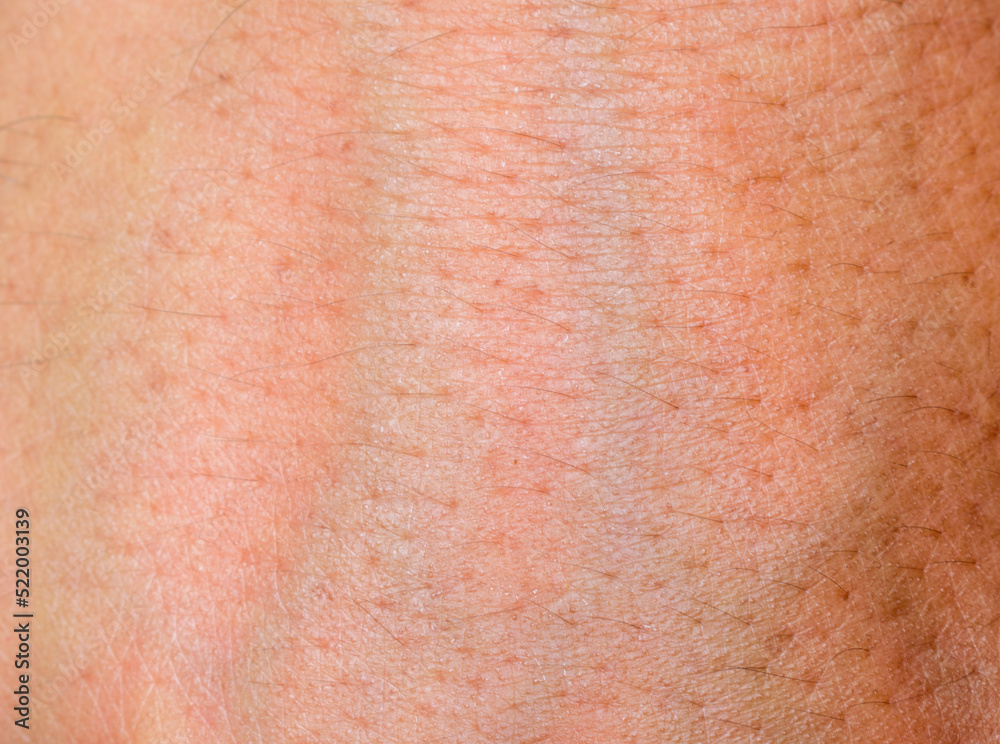 Texture texture Human skin close-up Veins, tendons, dark skin on the ...