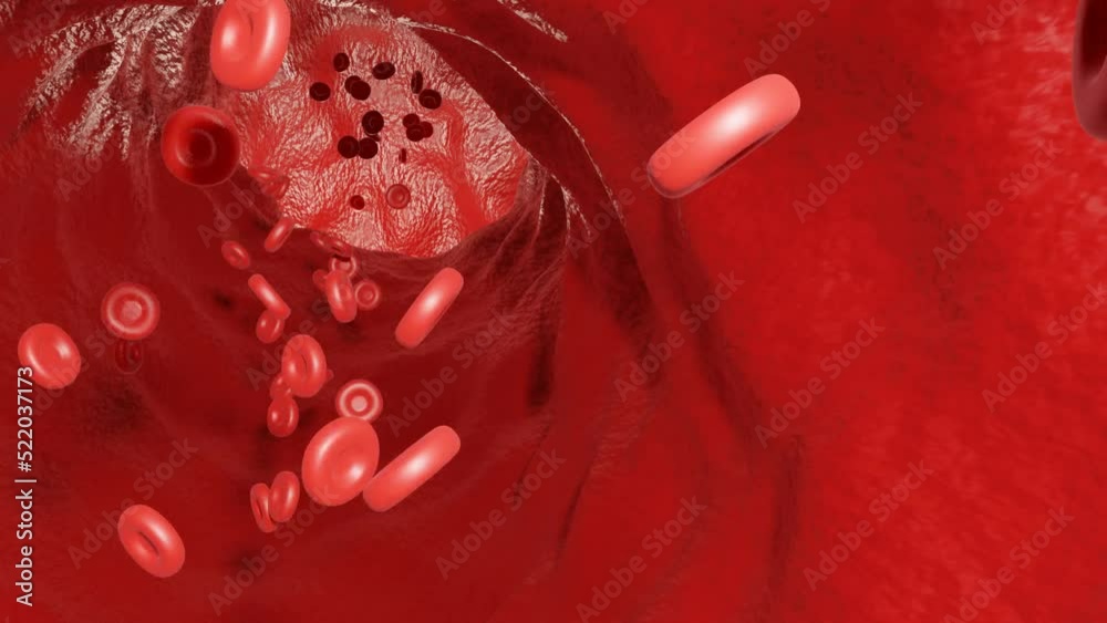Video Footage for Red blood cells look like a disc with indentations in ...