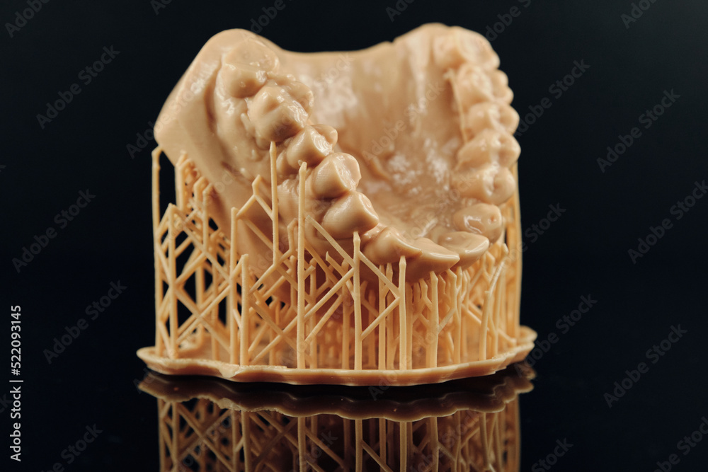 3D Printing Dental Crowns and Bridge Models. Orthodontic model for ...