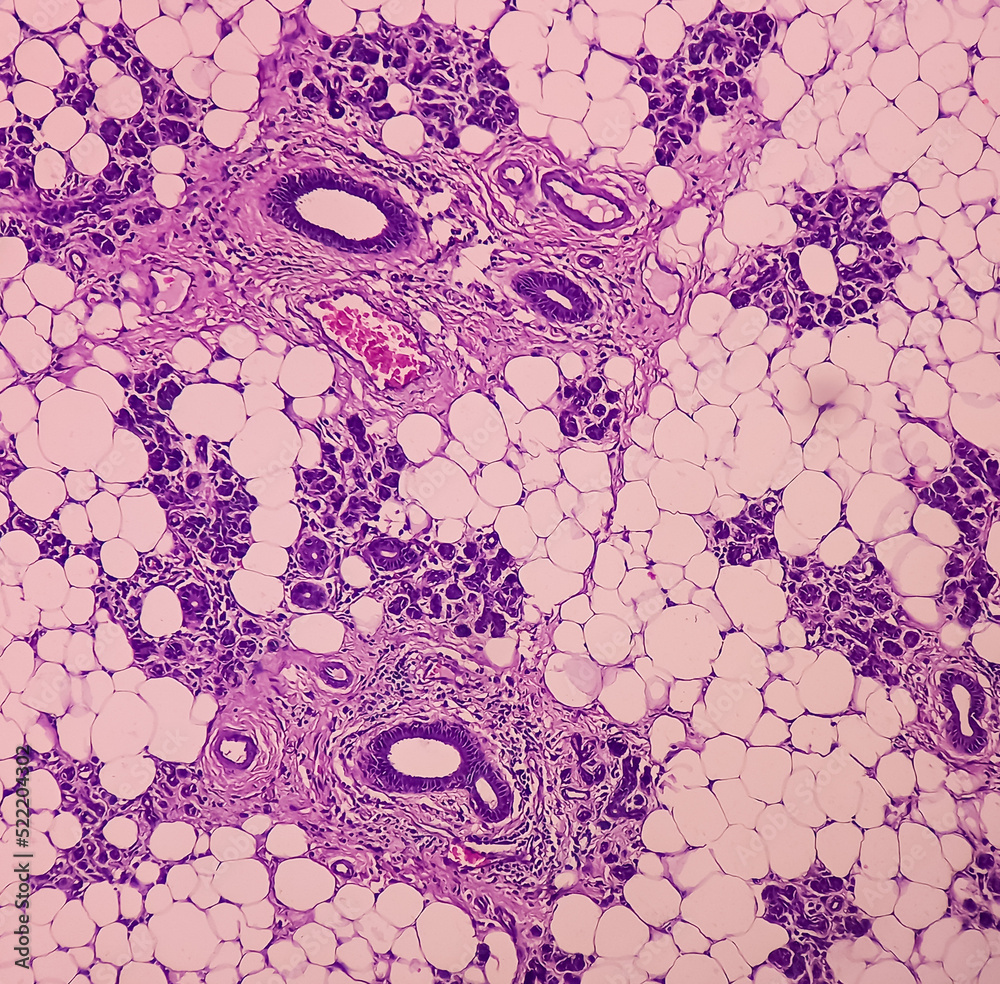 Parotid Histology