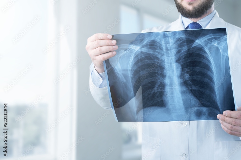 A surgeon doctor examining patient's x-ray films, scan in at radiology ...