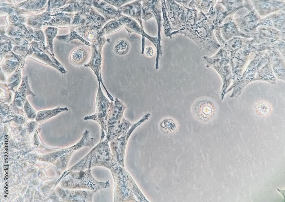 Human embryonic kidney (HEK293) cells cultured in vitro. Microscopic ...