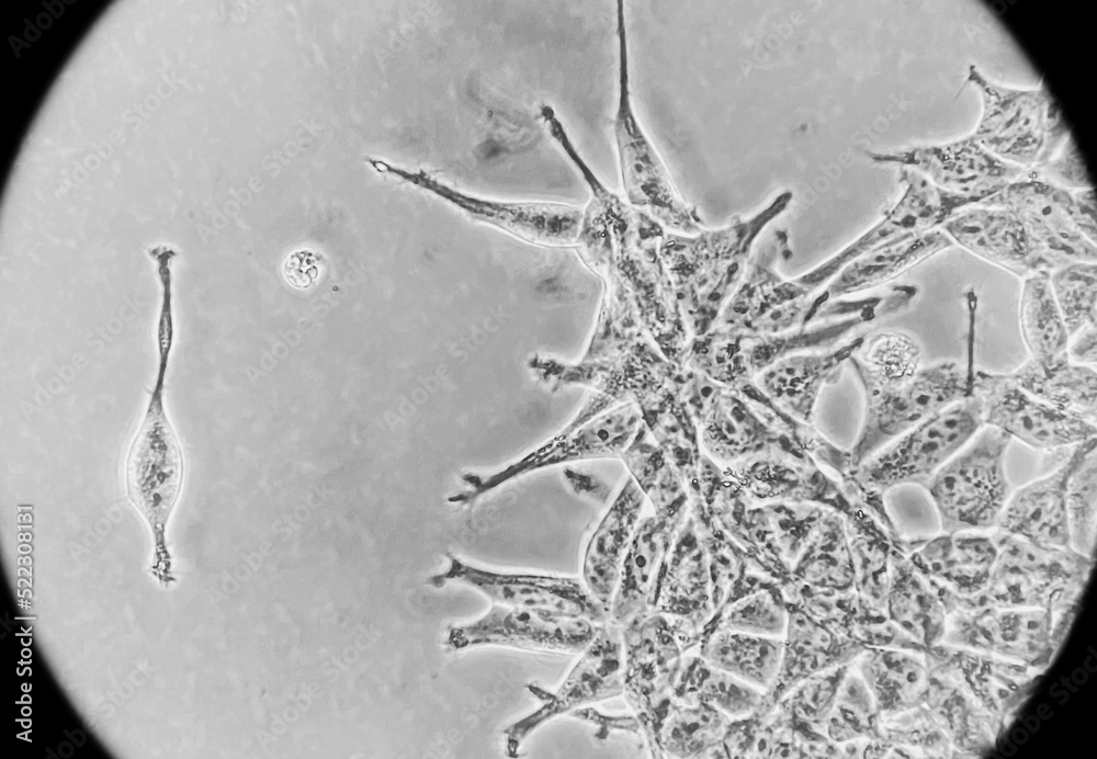Human embryonic kidney (HEK293) cells cultured in vitro. Microscopic ...