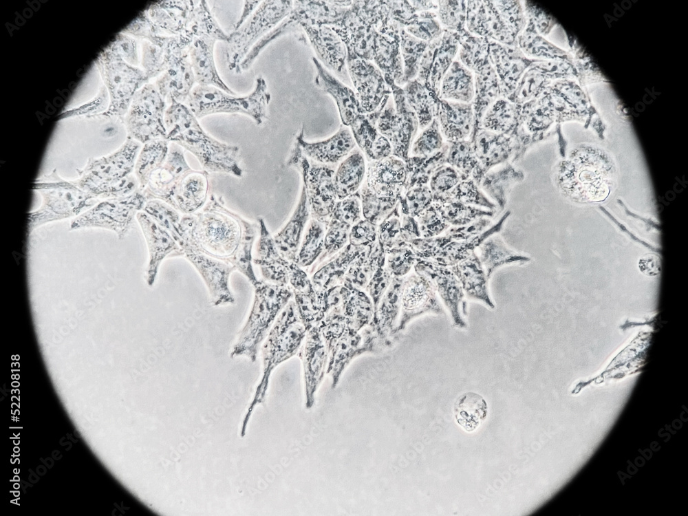 Human embryonic kidney (HEK293) cells cultured in vitro. Microscopic ...