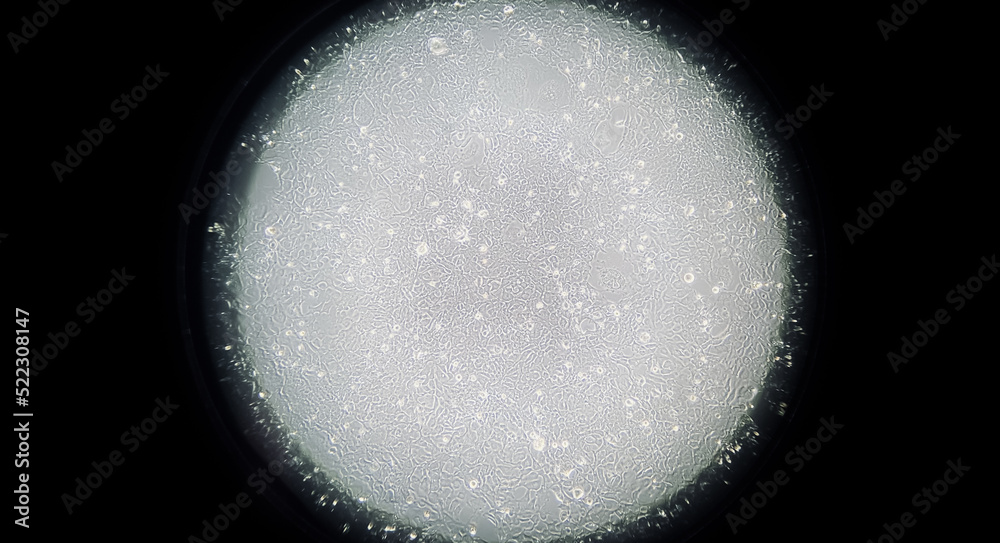 Human embryonic kidney (HEK293) cells cultured in vitro. Microscopic ...