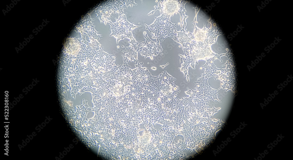 Human embryonic kidney (HEK293) cells cultured in vitro. Microscopic ...