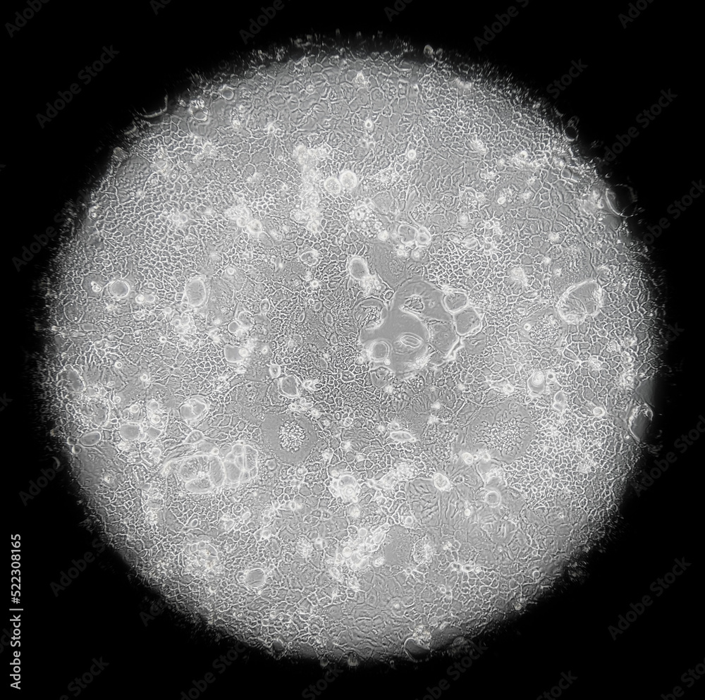 Human embryonic kidney (HEK293) cells cultured in vitro. Microscopic ...