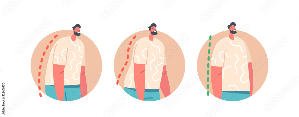 Scoliosis and Spine Backbone Curvature Isolated Round Icons or Avatars ...