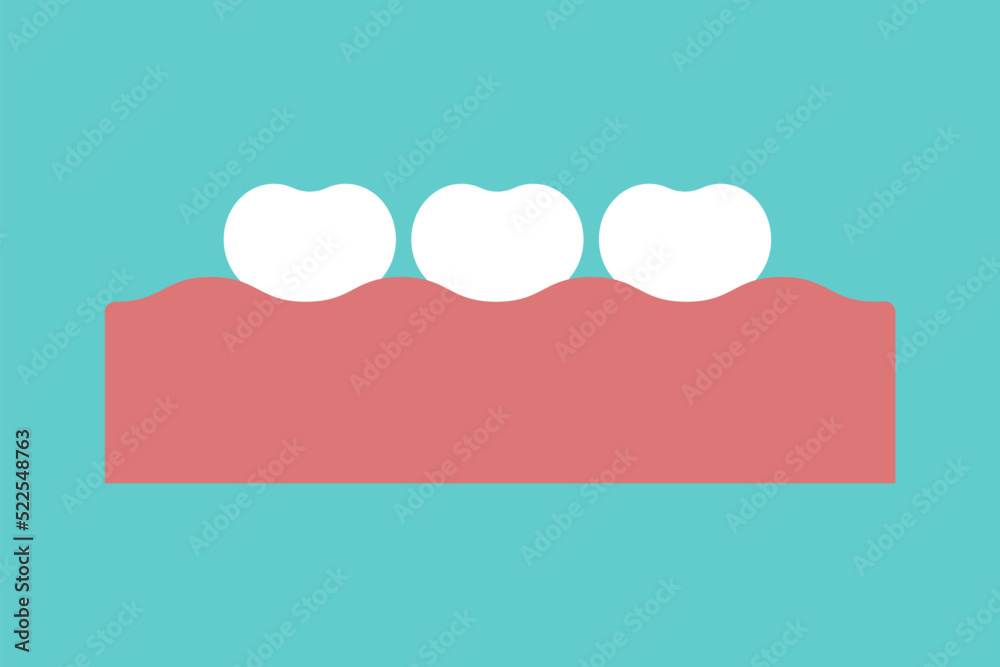 Teeth in the gum vector flat illustration design of orthodontics and ...