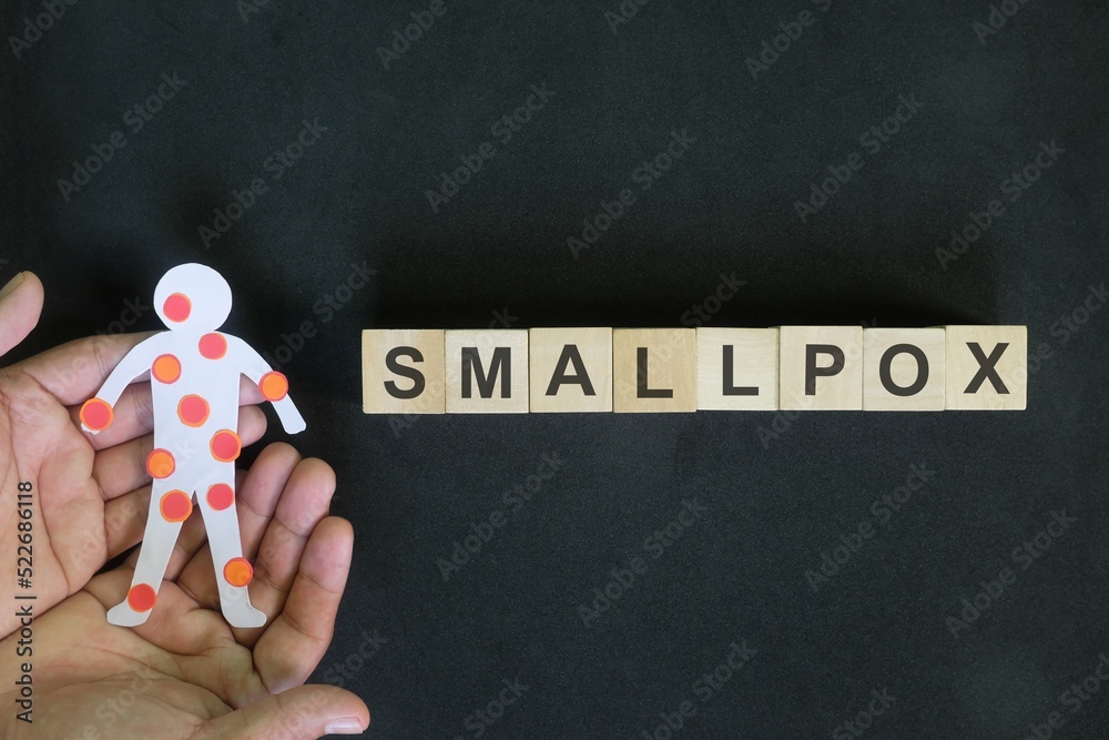 Smallpox disease infection outbreak care, prevention and protection ...