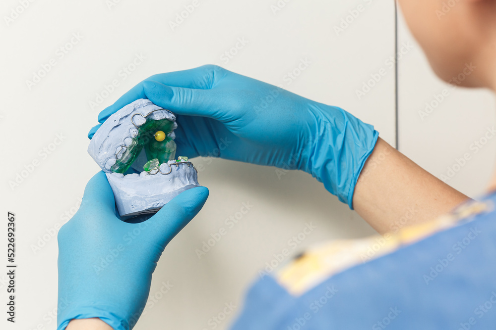 Dentist showing braces on artificial jaw. How to properly care for the ...