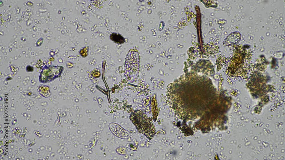 soil microbes organisms in a soil and compost sample, fungus and fungi ...