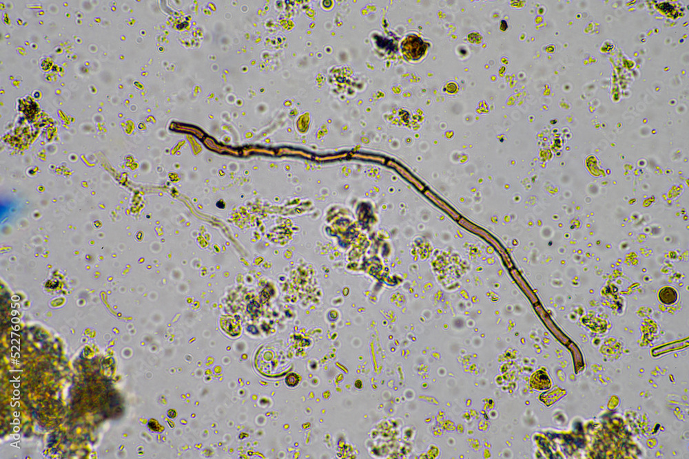 soil microbes organisms in a soil and compost sample, fungus and fungi ...