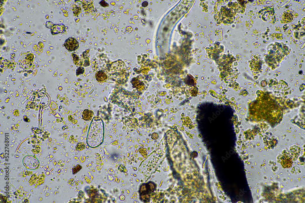soil microbes organisms in a soil and compost sample, fungus and fungi ...