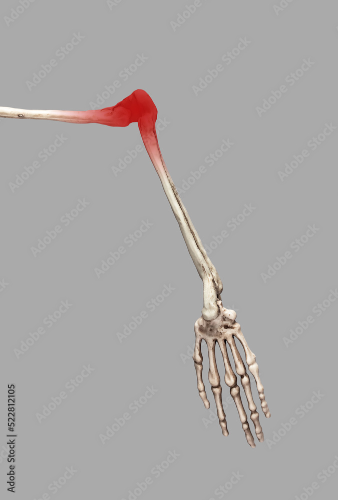 Human skeleton arm with red elbow. Sports trauma, injury, overuse ...