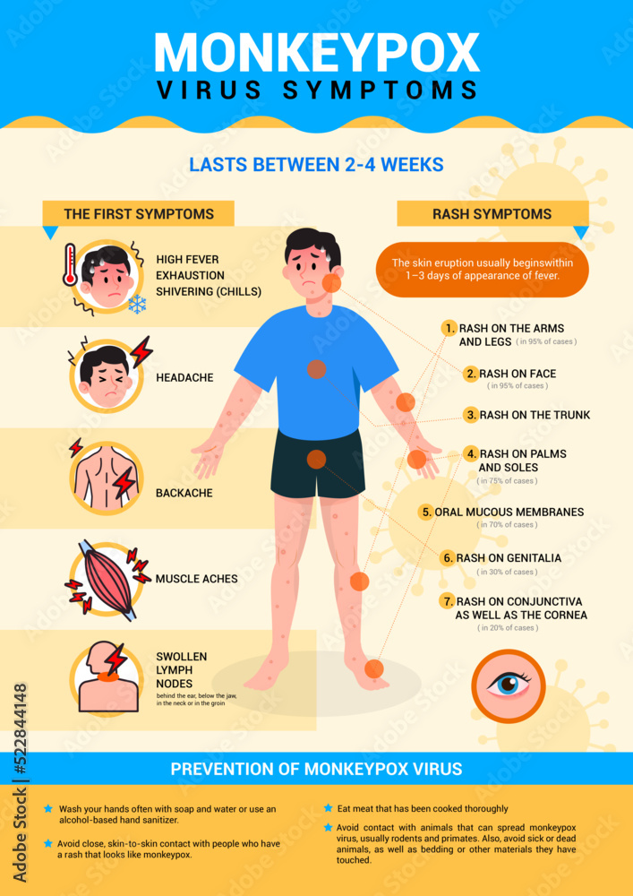 Monkeypox virus symptoms and prevention infographic poster vector ...
