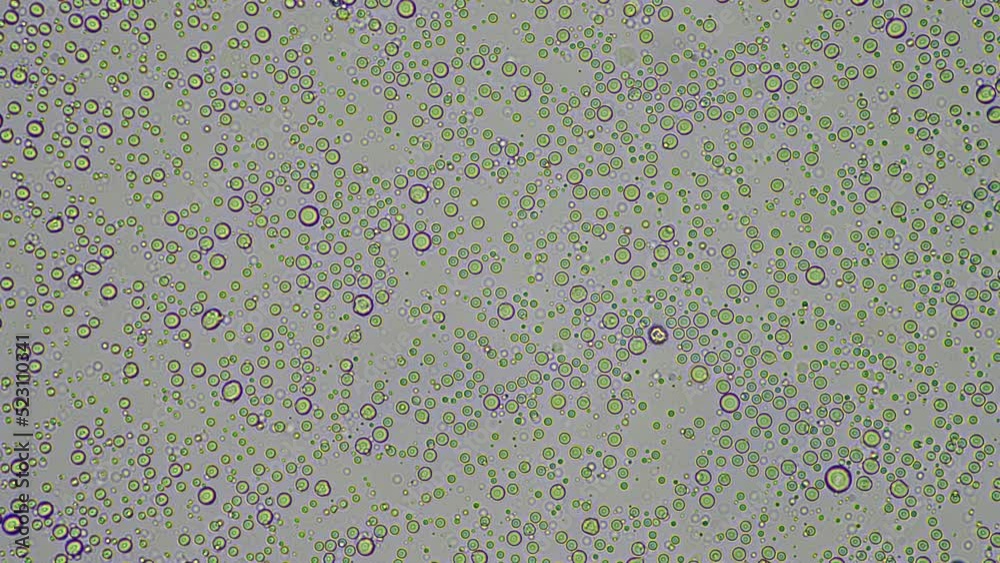 Breast milk under the microscope, woman lactating milk Feeding a baby ...