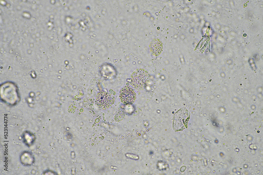 coughing, Phlegm and mucus under the microscope Stock Photo | Adobe Stock