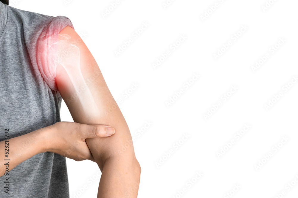 Inflammation of the muscles and bones of the arm Stock Photo | Adobe Stock