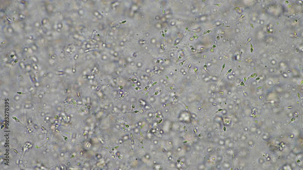 Sperm under the microscope. Looking a semen swimming. Healthy fertile ...