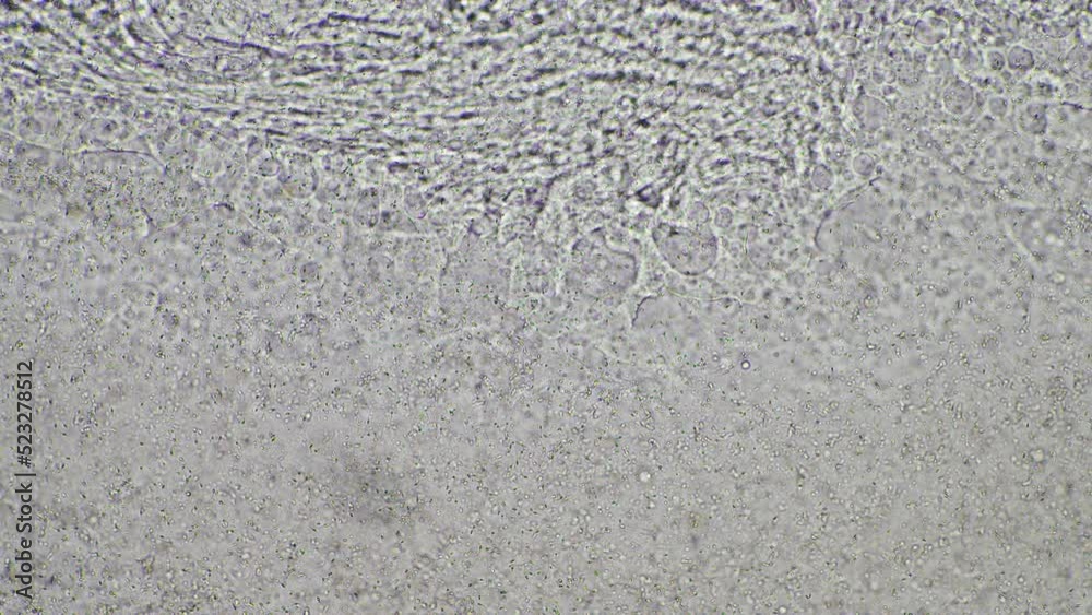 Sperm under the microscope. Looking a semen swimming. Healthy fertile ...