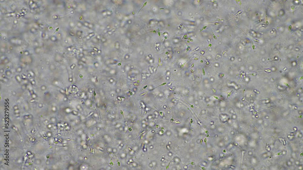 Sperm under the microscope. Looking a semen swimming. Healthy fertile ...
