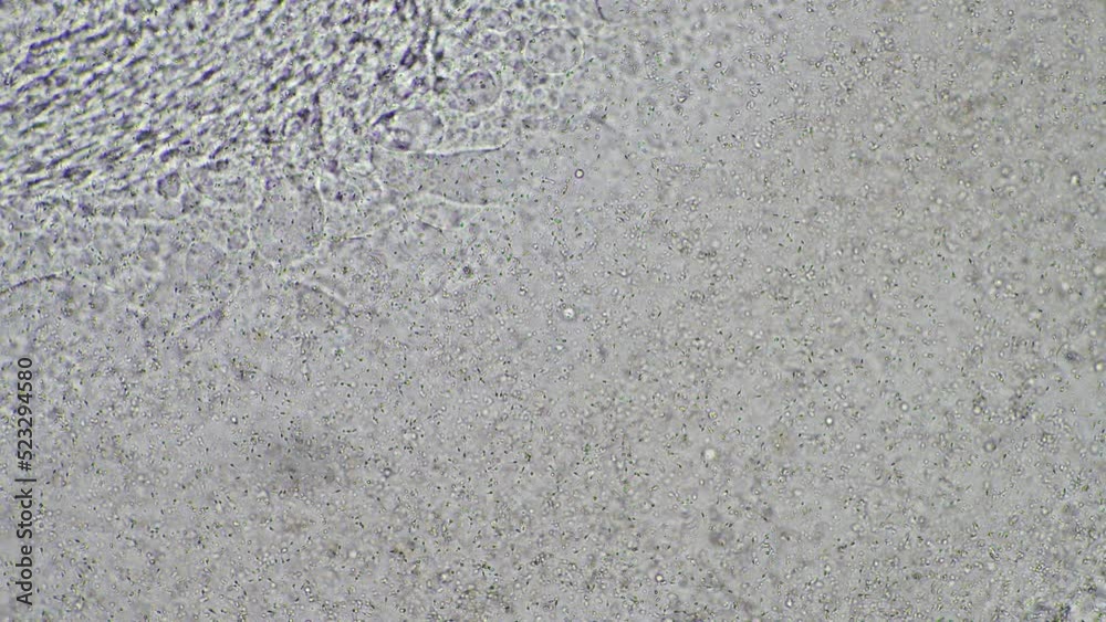 Sperm under the microscope. Looking a semen swimming. Healthy fertile ...