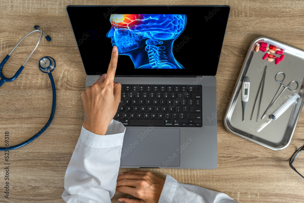 Top view of doctor showing a x-ray of pain in the brain on a laptop ...