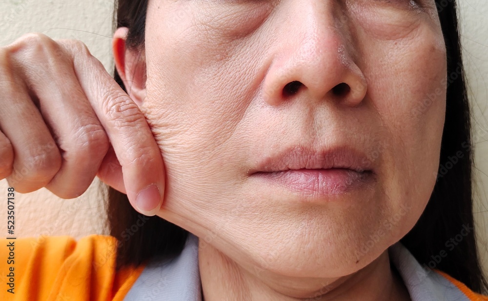 Portrait showing the hand squeezing the flabbiness adipose sagging skin ...