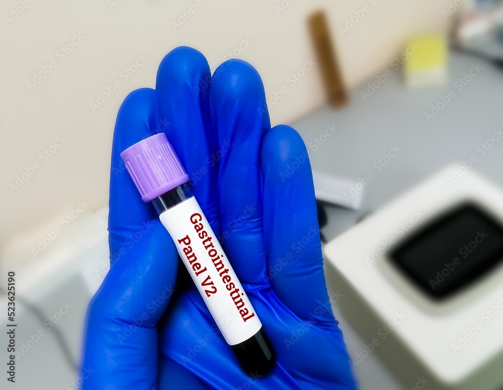 Blood sample on scientist hand for gastrointestinal Panel v2 PCR test ...