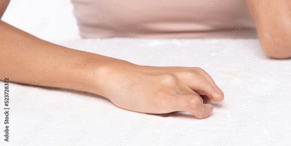 Disabled person hand without fingers since childhood brith, no thumb ...